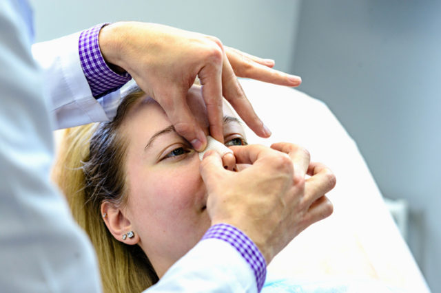 Dealing With Facial Injuries After an Accident